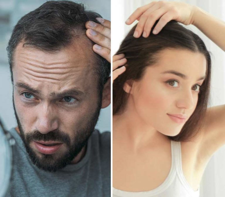 De 16 beste haargroeimiddelen voor vrouwen en mannen in de test